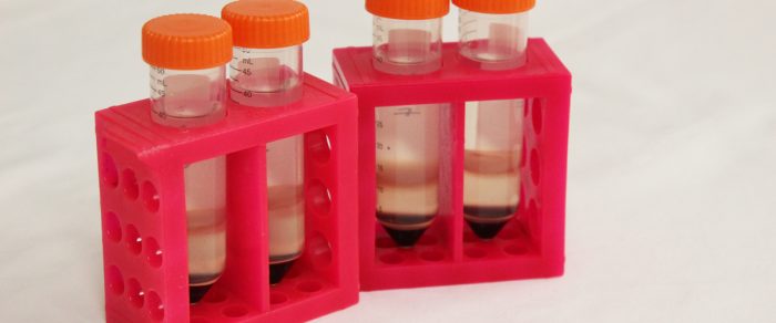 buffy-coat — Stanford Blood Center