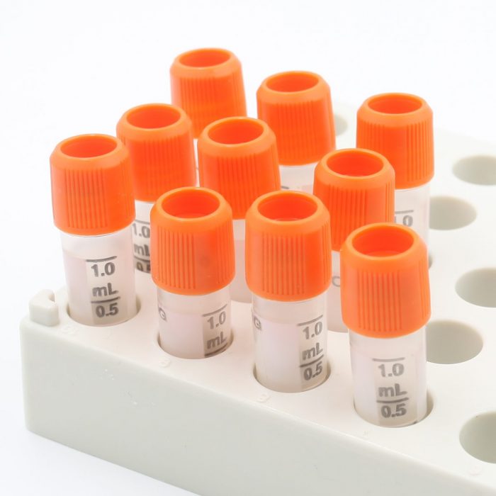 Cryopreserved Primary Cells — Stanford Blood Center