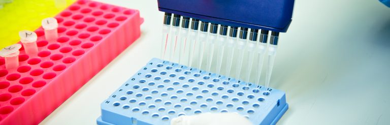 Histocompatibility & Immunogenetics Laboratory (HLA Lab) — Stanford ...